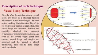 Closure of Fasciotomy wounds. A Dermatotracion technical modification.pptx