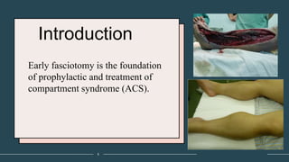 Closure of Fasciotomy wounds. A Dermatotracion technical modification.pptx