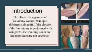 Closure of Fasciotomy wounds. A Dermatotracion technical modification.pptx