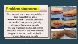 Closure of Fasciotomy wounds. A Dermatotracion technical modification.pptx