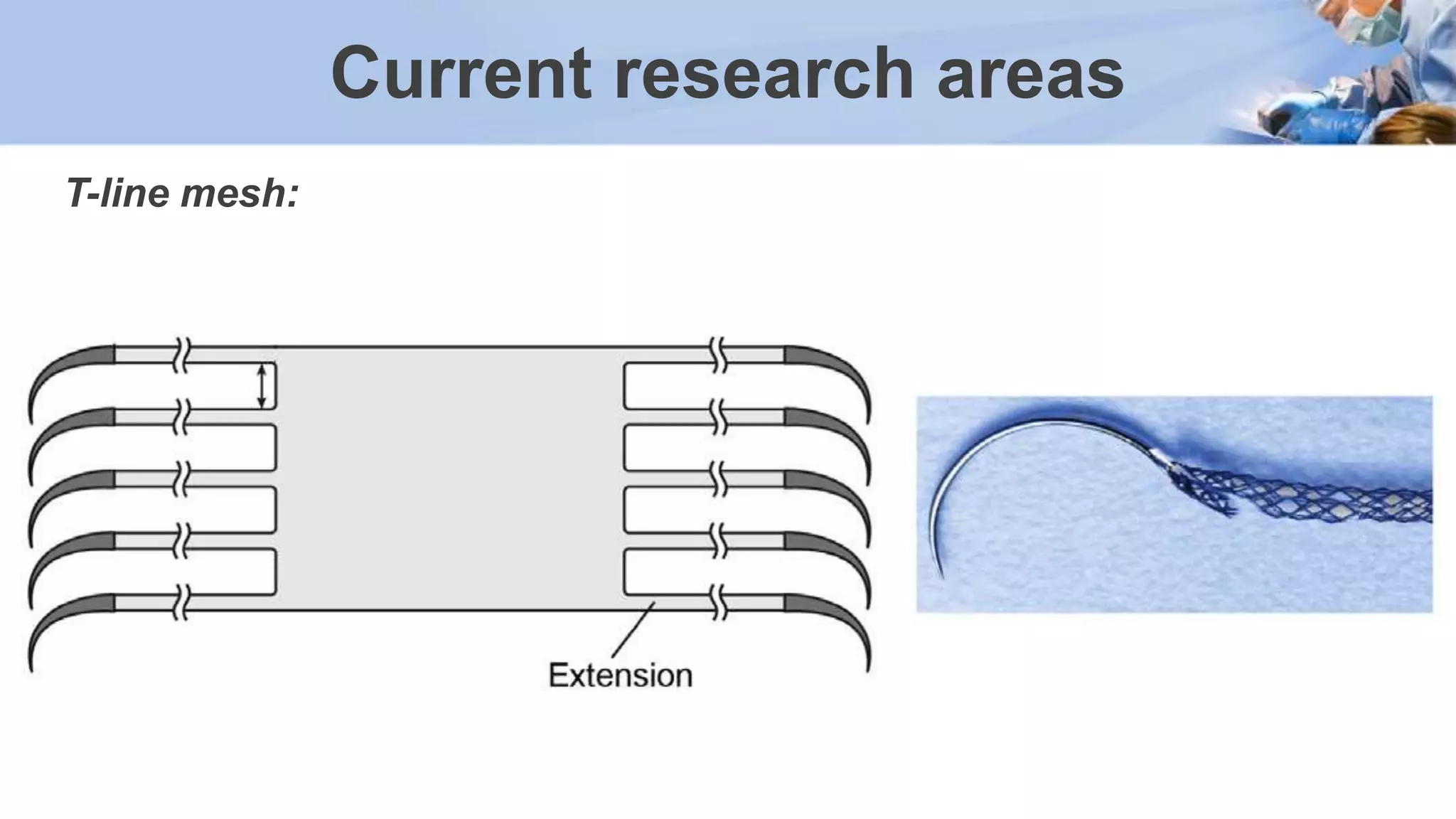 Guidelines on closure of laparotomy and prevention of incisional hernia ...