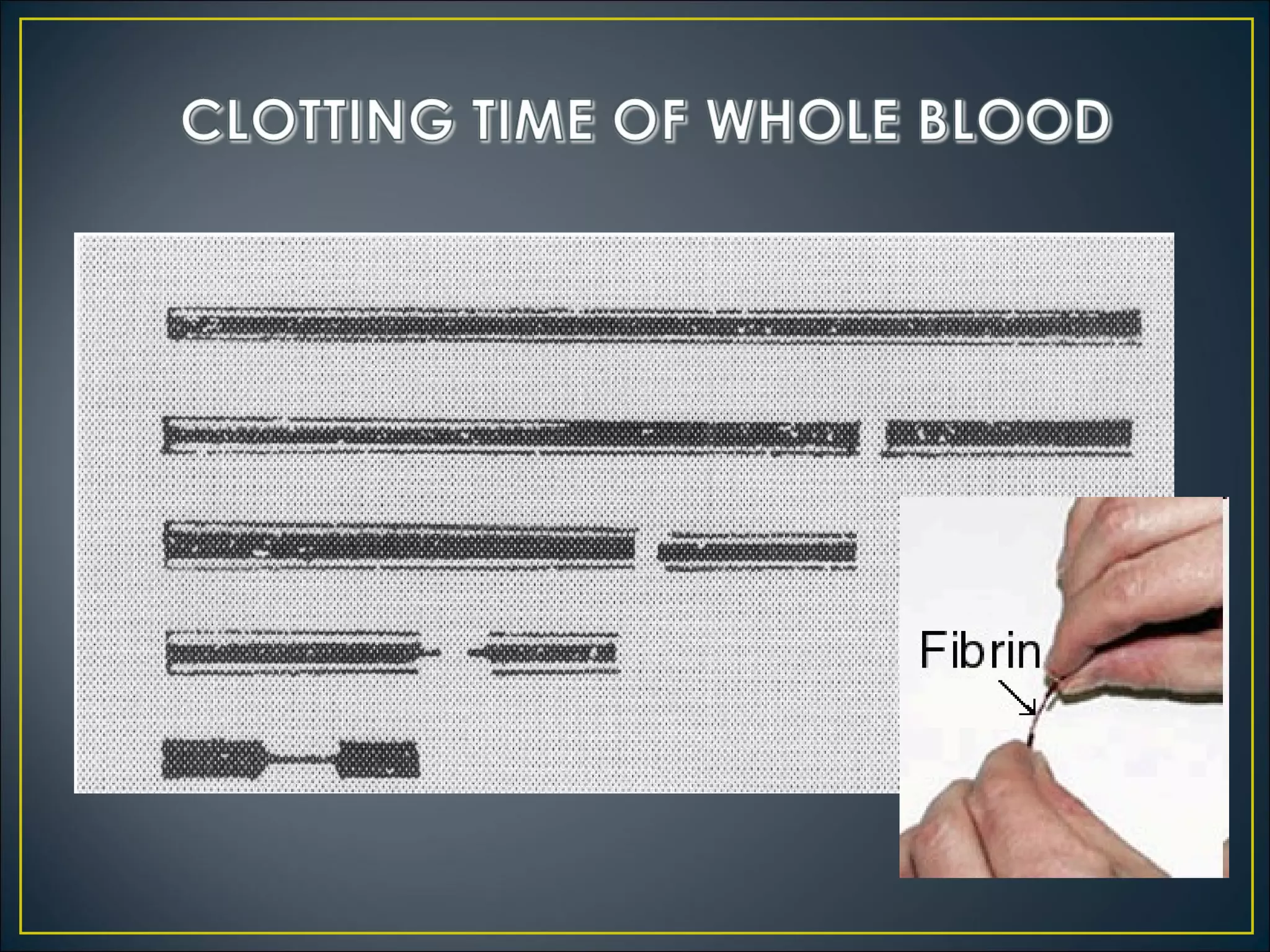 Clotting time - Coagulation of whole blood | PPT