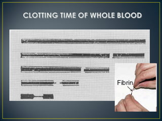Clotting time - Coagulation of whole blood | PPT