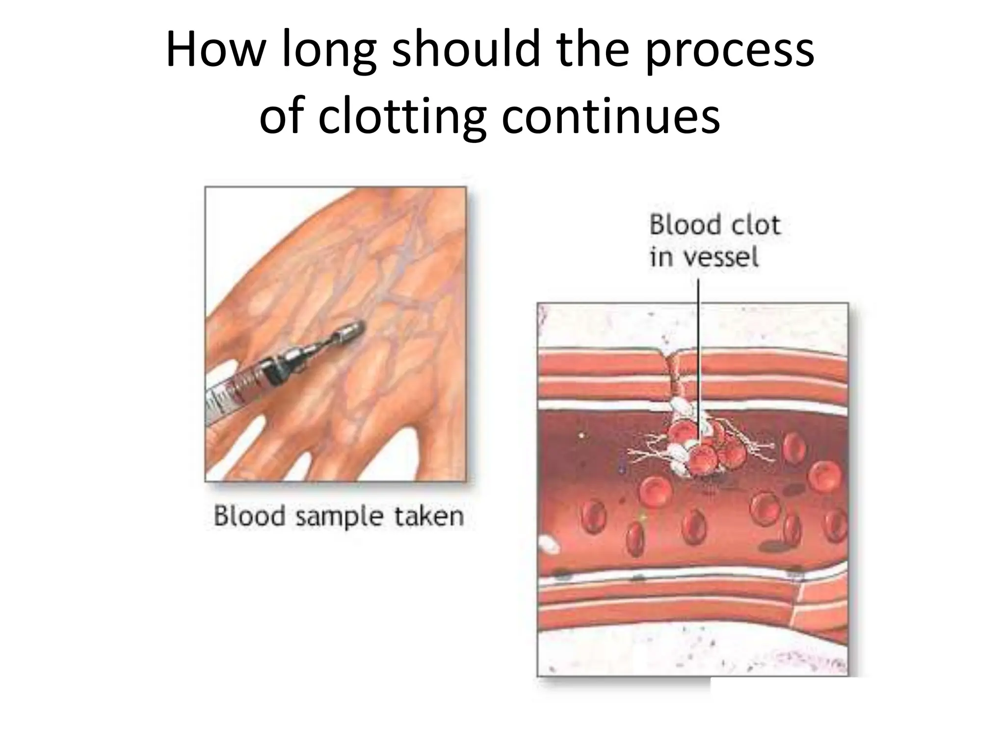Blood Physiology Clotting mechanism (2).pptx