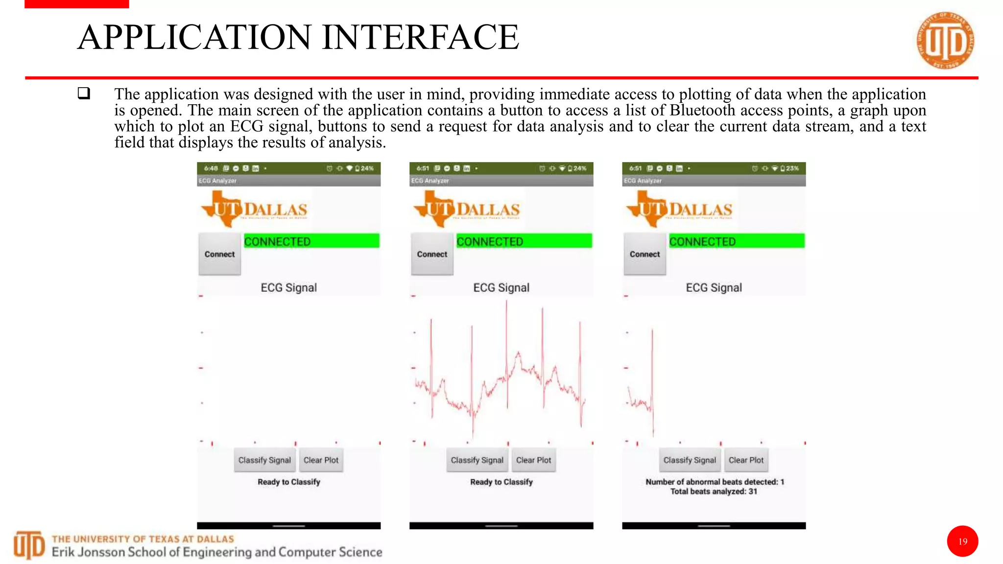 Cloud-based ECG classification with mobile interface.pptx