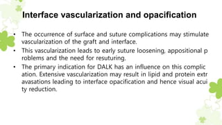 Postoperative Complication of DALK | PPTX