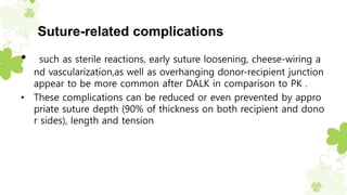 Postoperative Complication of DALK | PPTX