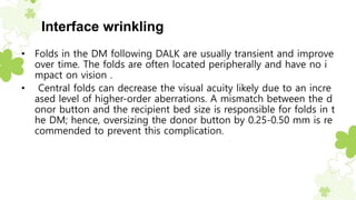 Postoperative Complication of DALK | PPTX