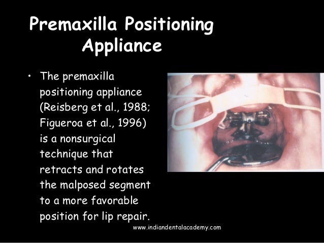ClEFT LIP AND PALATE / DENTAL COURSES