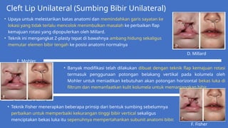 Cleft Lip and Palate atau Sumbing pada bibir dan langitan | PPTX