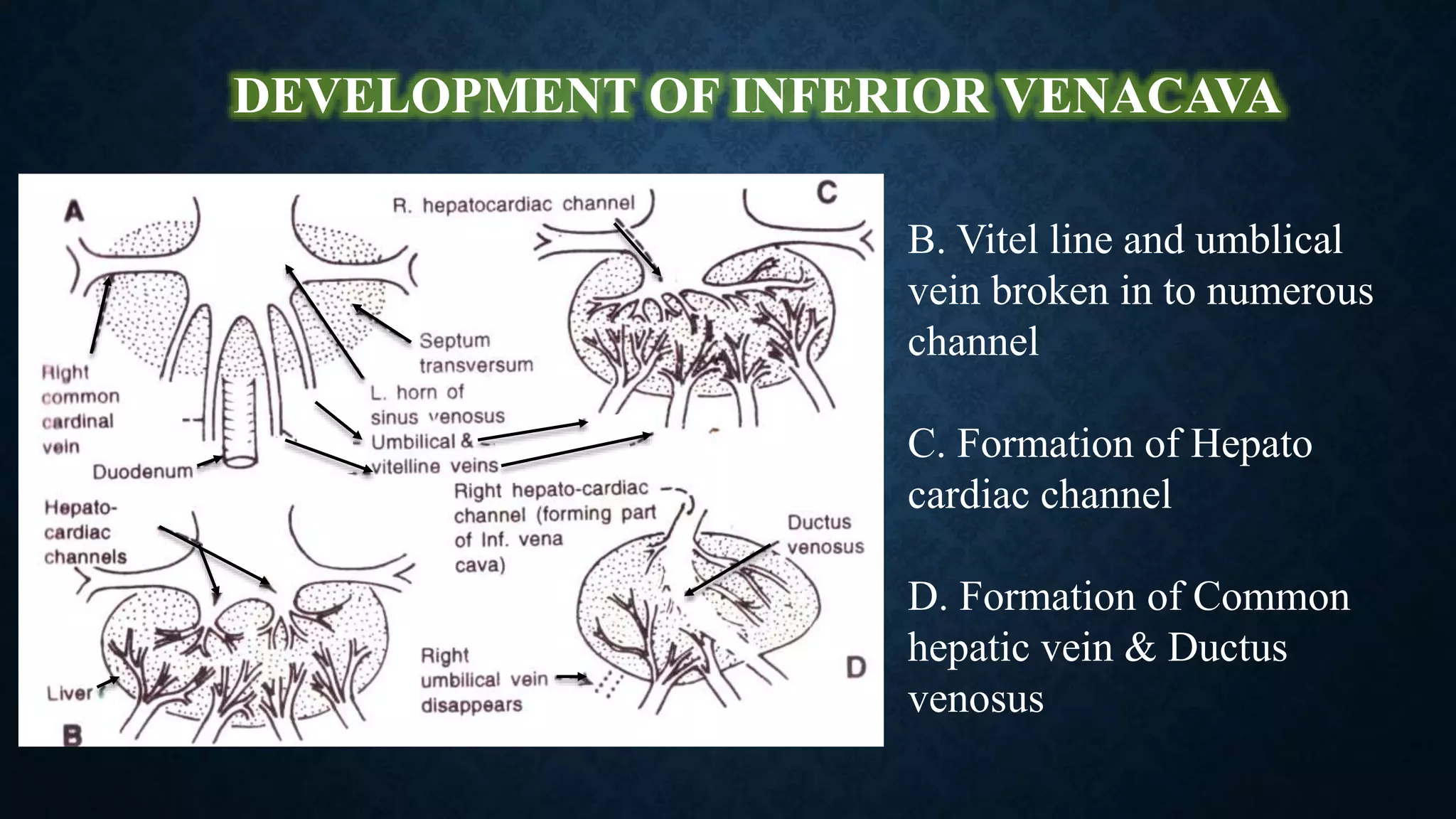 Anomalies development of vein | PPTX