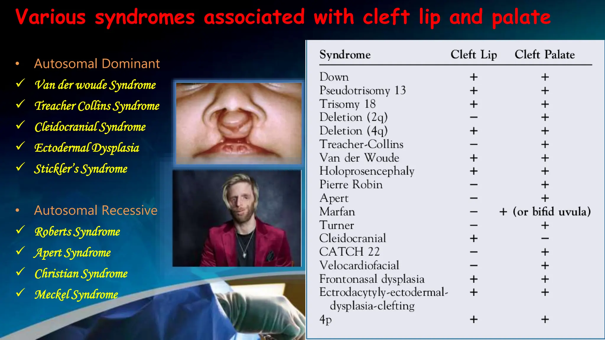 CLEFT LIP AND PALATE IN ORTHODONTICS.pptx