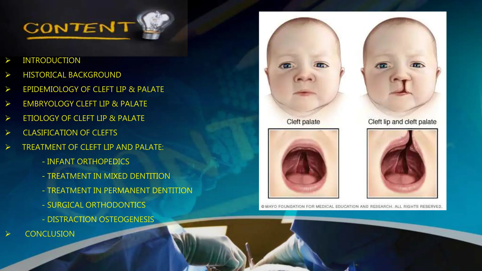 CLEFT LIP AND PALATE IN ORTHODONTICS.pptx