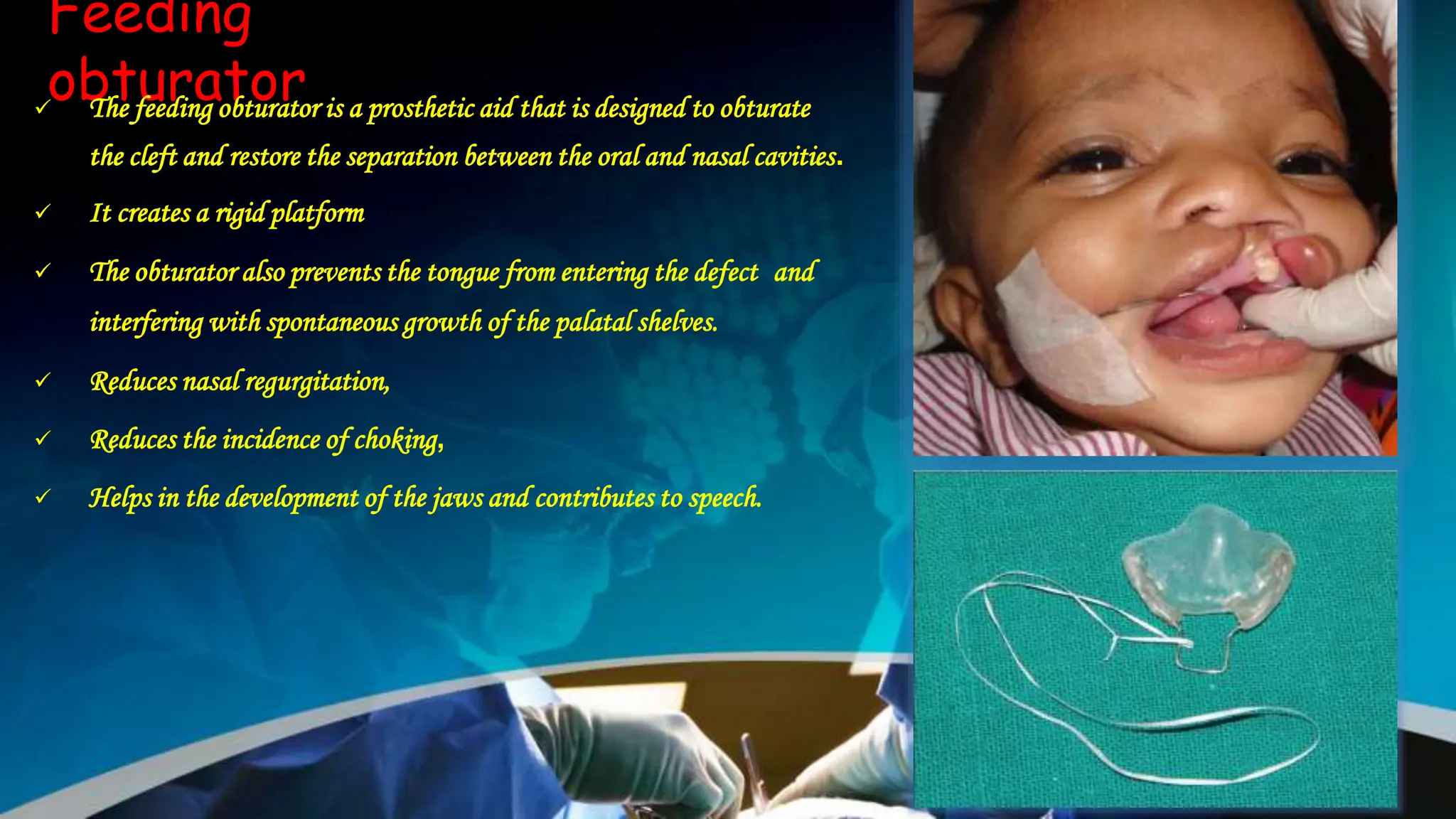 CLEFT LIP AND PALATE IN ORTHODONTICS.pptx