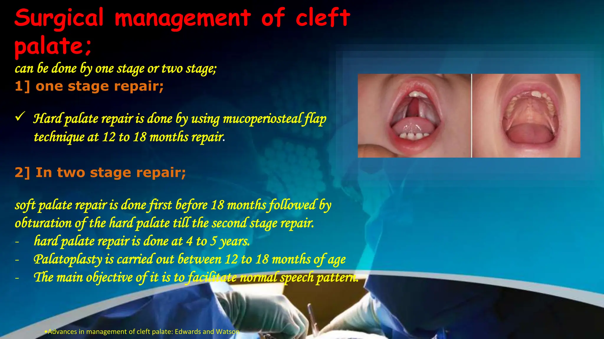 CLEFT LIP AND PALATE IN ORTHODONTICS.pptx