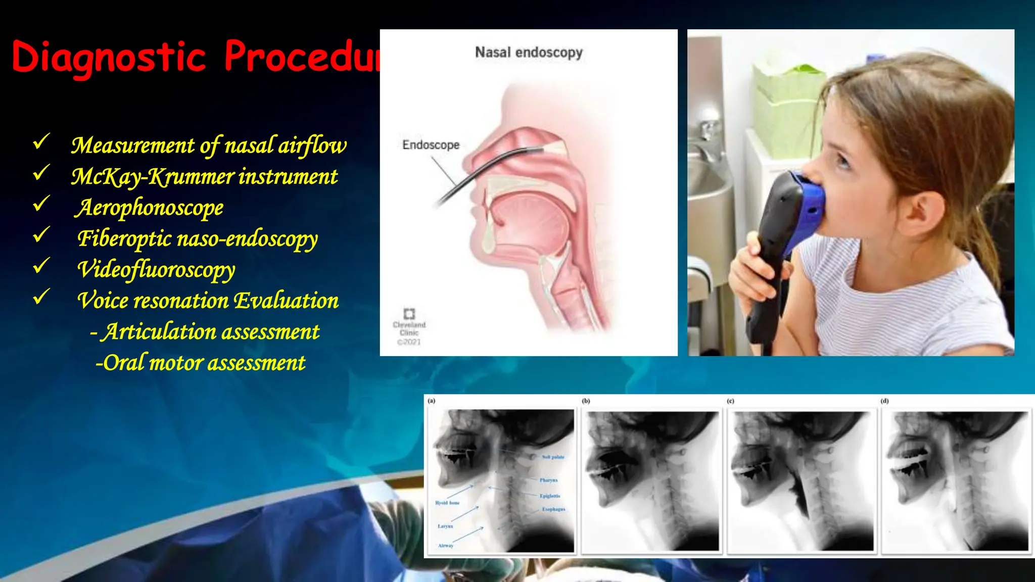 CLEFT LIP AND PALATE IN ORTHODONTICS.pptx