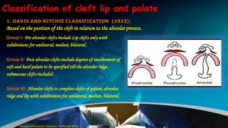 CLEFT LIP AND PALATE IN ORTHODONTICS.pptx