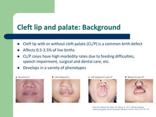 Cleft lip and palate: Examining variations on ZEB1 gene | PPT