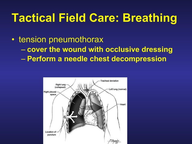 Cls | PPT