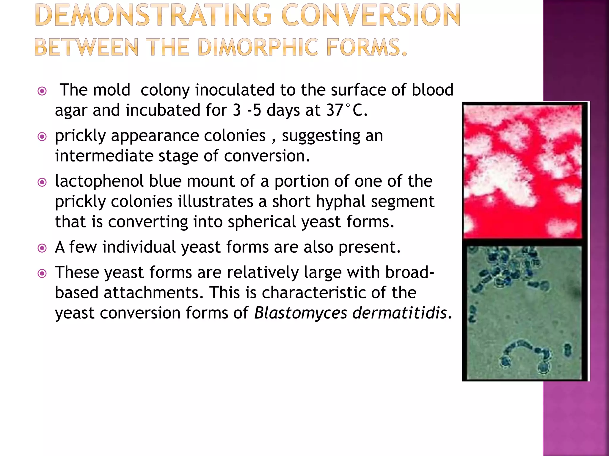 CLS Blastomyces dermatitidis.pptx