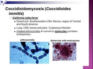 Coccidioides Immitis