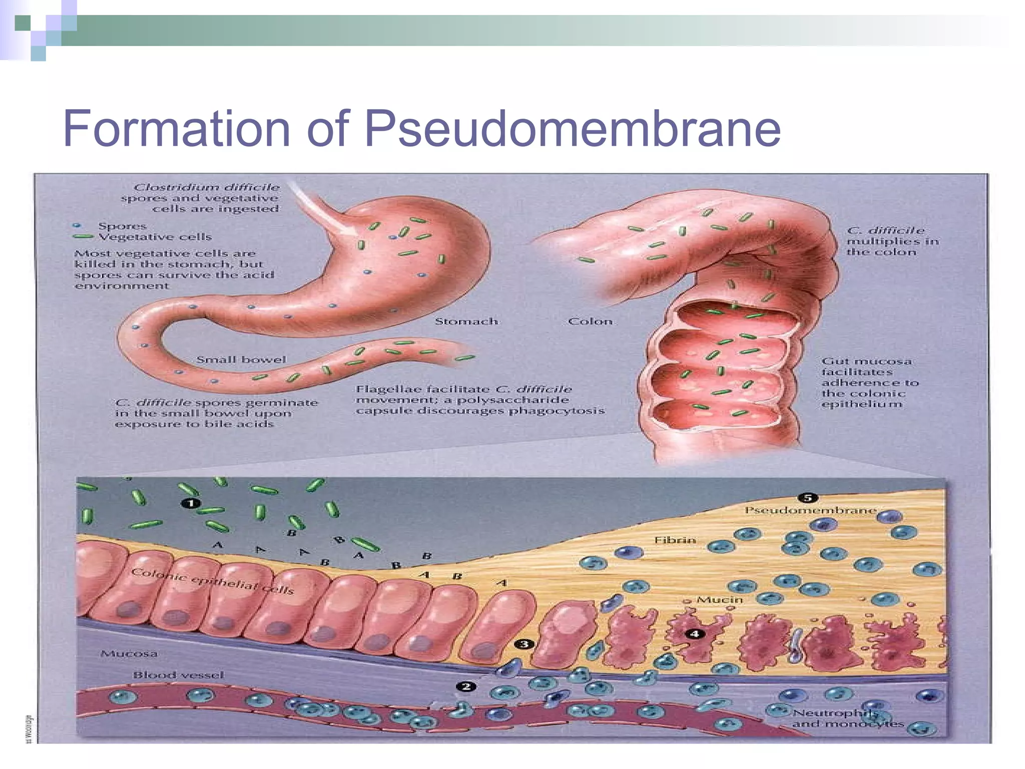 Cl tetani + cl difficile | PPT