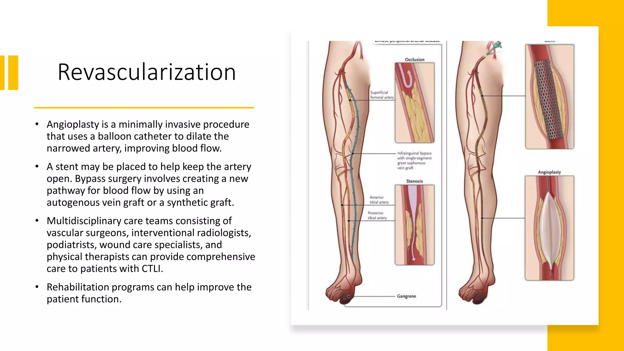 Chronic Threatening Limb Ischemia CTLI | PPSX