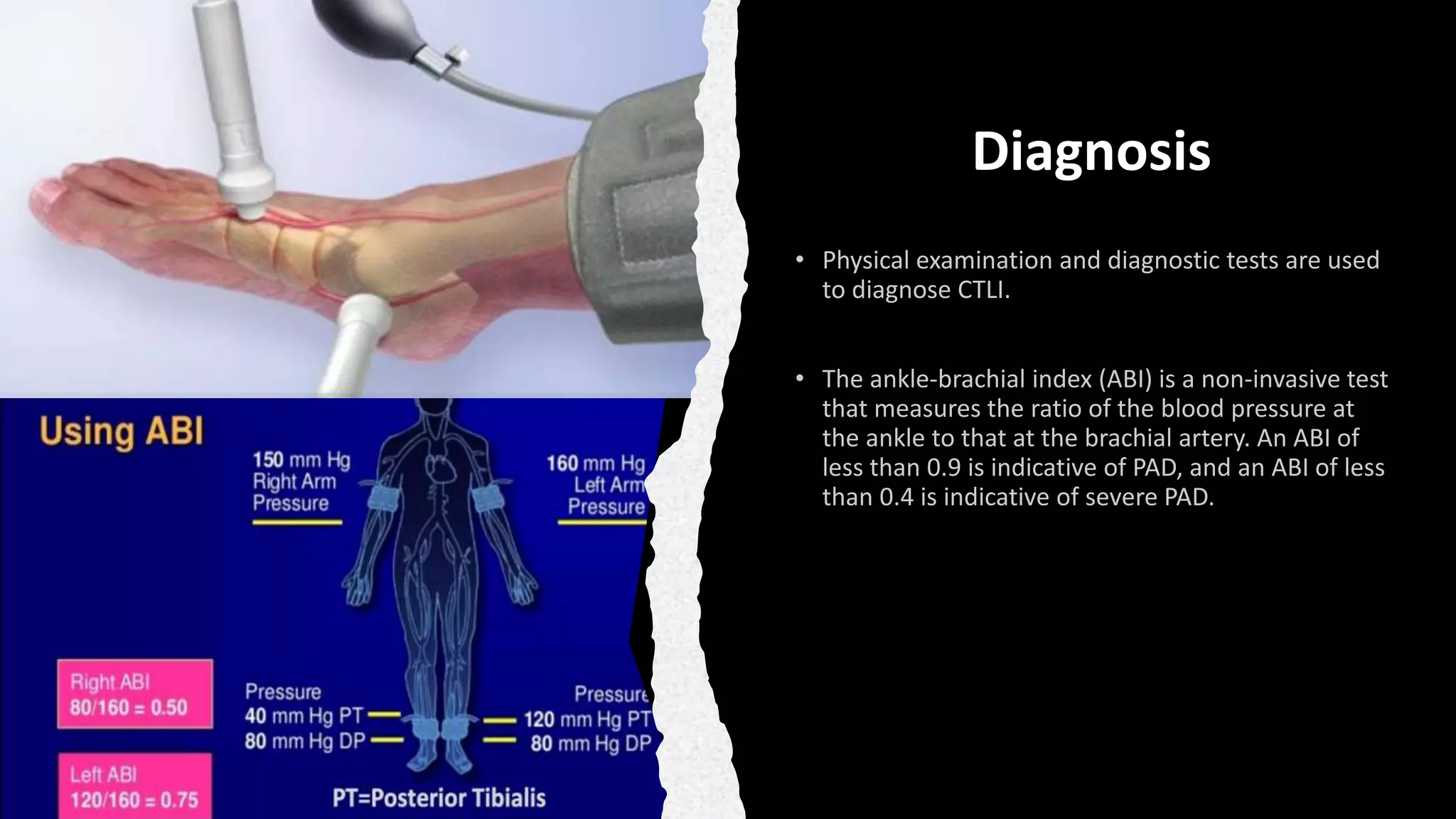 Chronic Threatening Limb Ischemia CTLI | PPSX