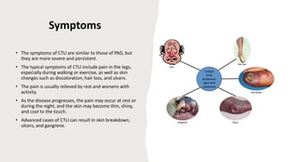 Chronic Threatening Limb Ischemia CTLI | PPSX