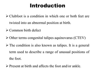 Clubb foot | PPTX