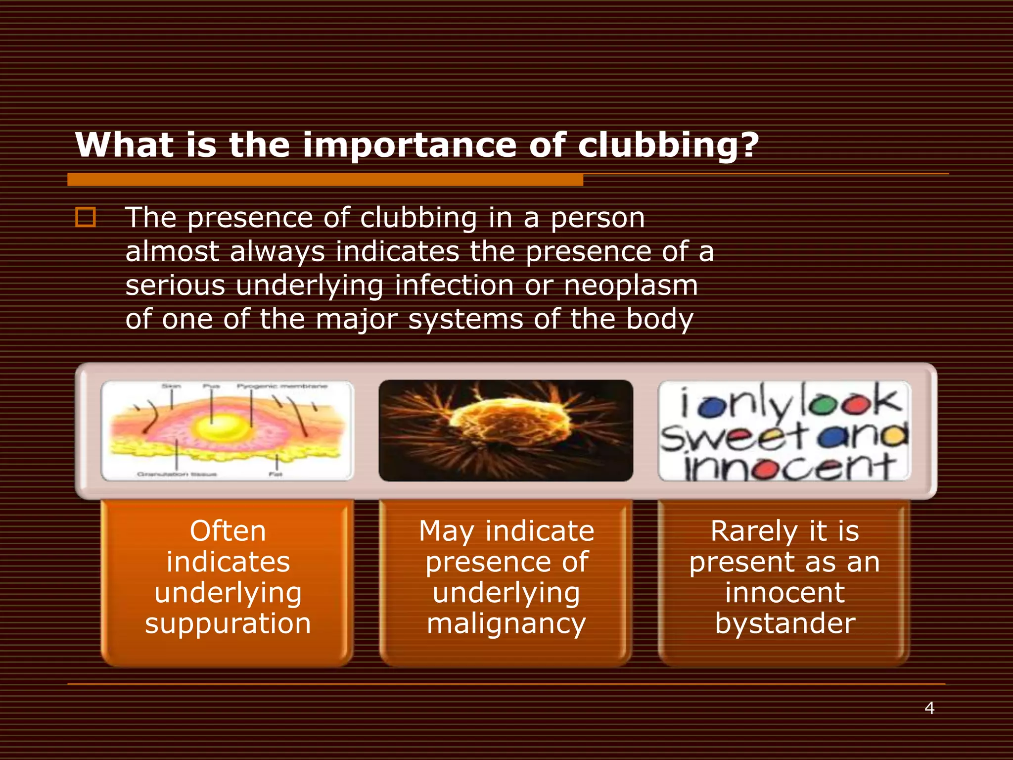 Clubbing | PPTX