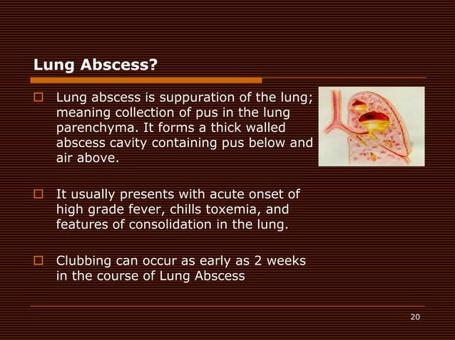 Clubbing | PPTX | Nail Care | Beauty