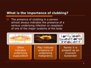 Clubbing | PPT