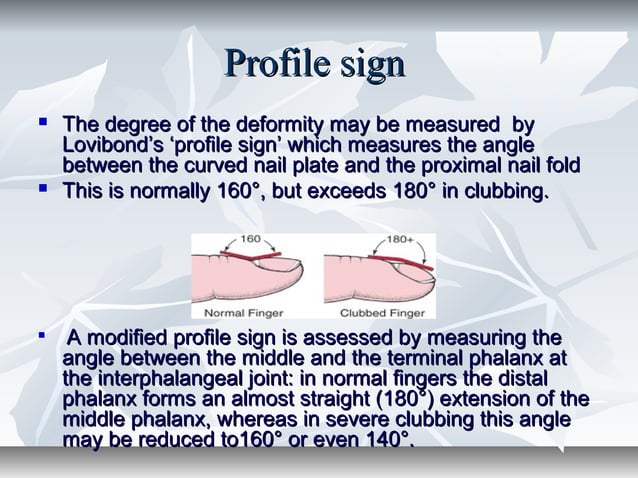 Clubbing | PPT | Lung and Respiratory Health | Diseases and Conditions