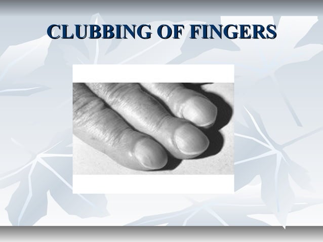Clubbing | PPT | Lung and Respiratory Health | Diseases and Conditions