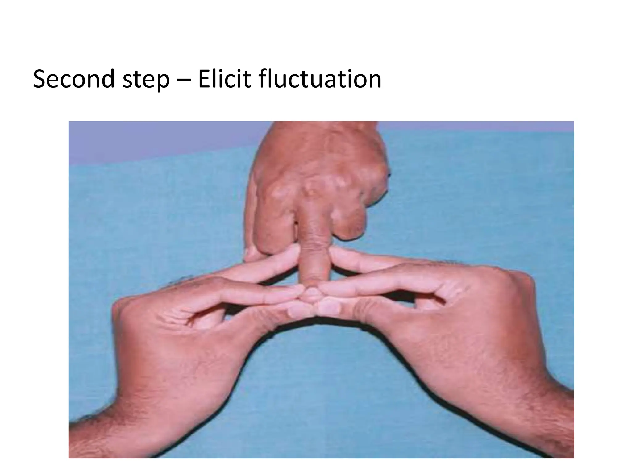 General physical examination CLUBBING.pptx