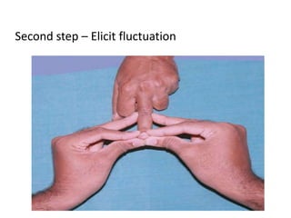 General physical examination CLUBBING.pptx