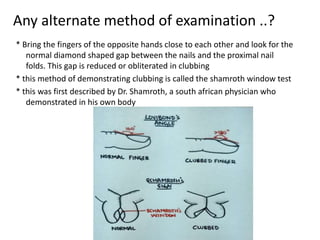 General physical examination CLUBBING.pptx