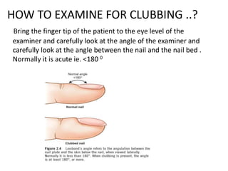 General physical examination CLUBBING.pptx