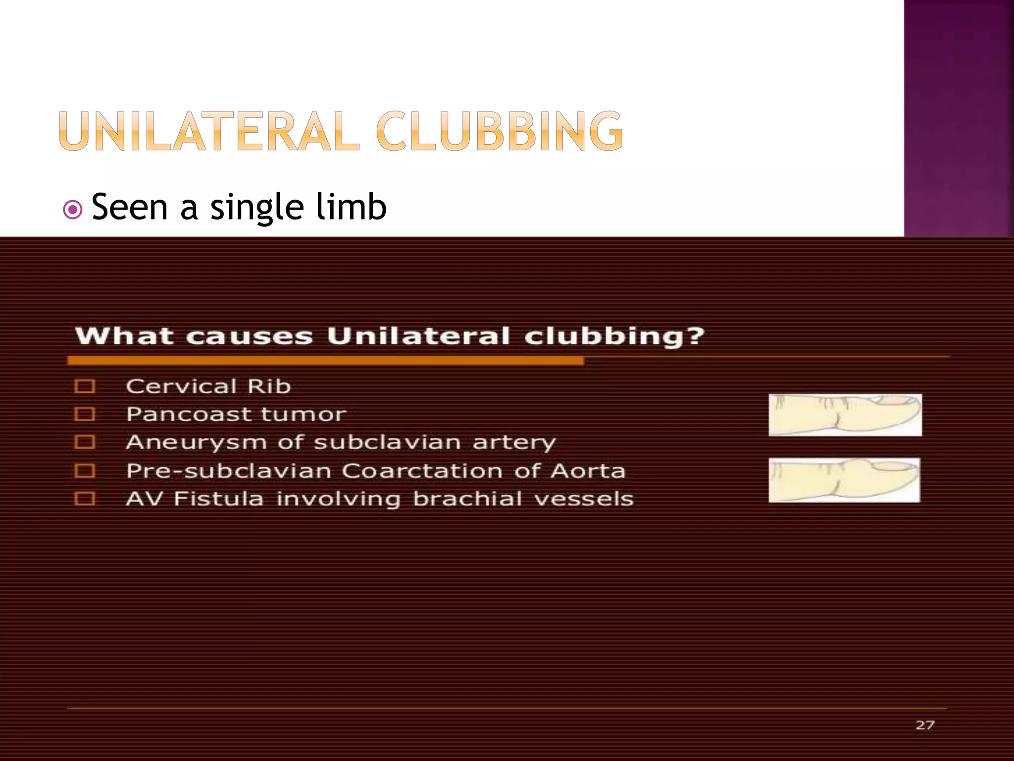 Clubbing agp | PPT