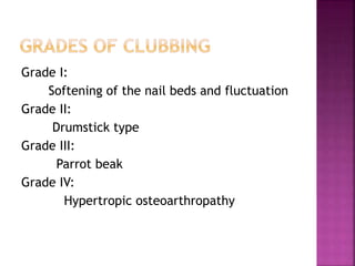 Clubbing agp | PPT
