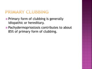 Clubbing agp | PPT