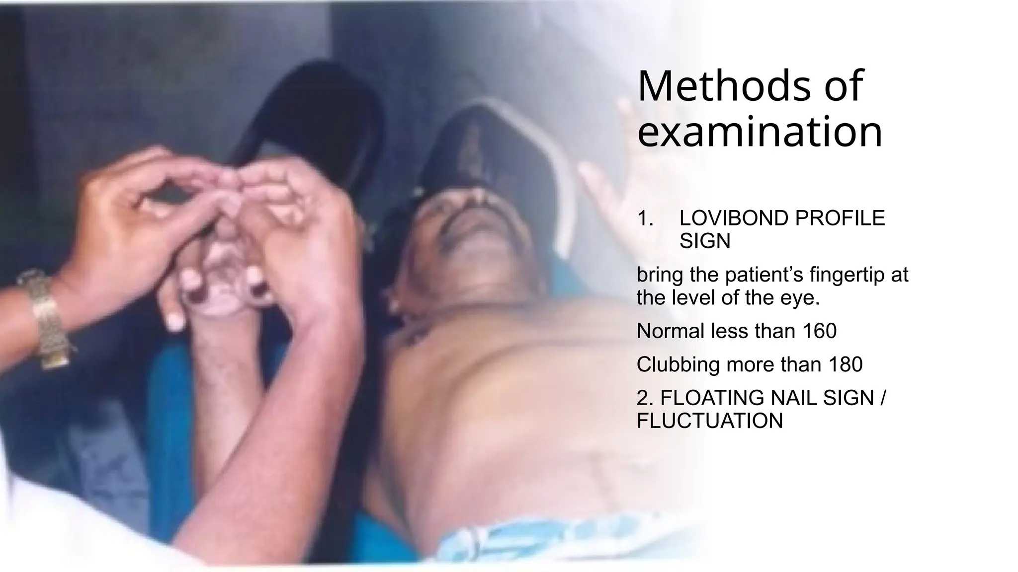 clubbing ppt.pptx. definition, clinical signs, grades. Causes | PPTX