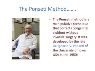 Clubfoot:The Ponseti Method | PPTX