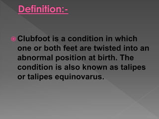 Club foot | PDF