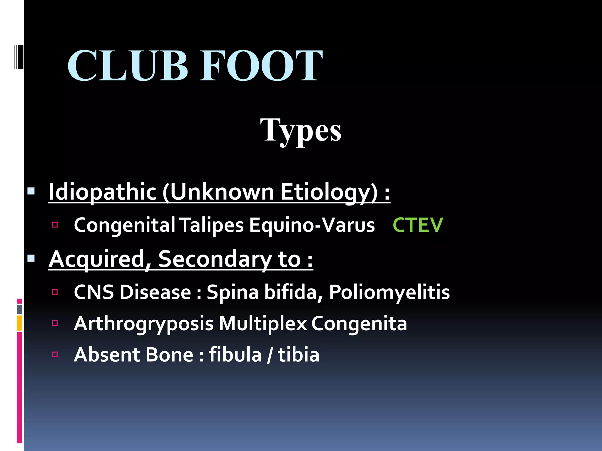 Club foot | PPTX