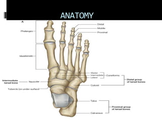 Club foot | PPTX