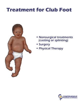 Club Foot | PDF