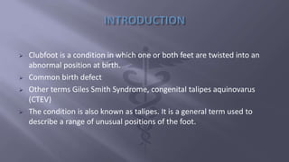 Club foot | PPTX