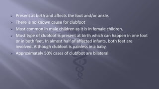 Club foot | PPTX